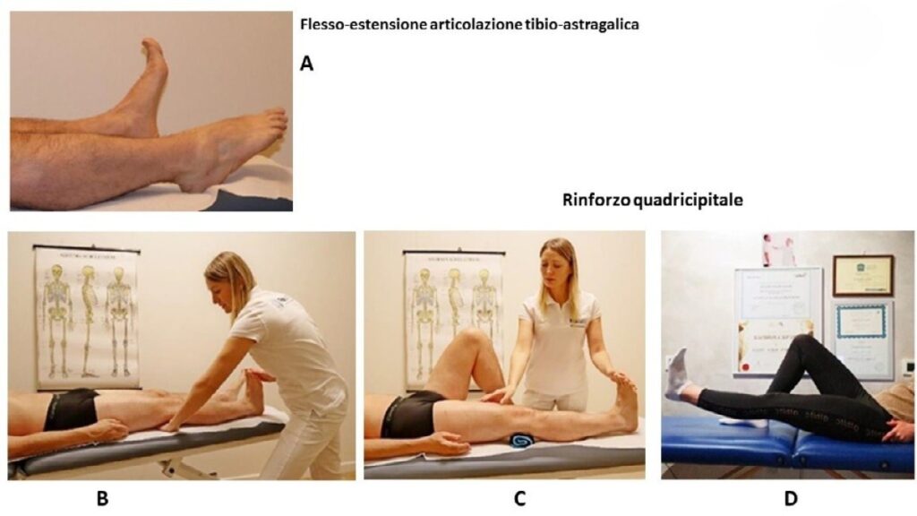 Riabilitazione frattura femore | Fisiosportlife