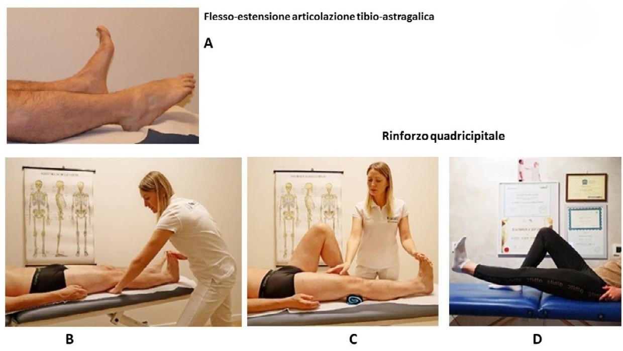 Riabilitazione frattura femore | Fisiosportlife